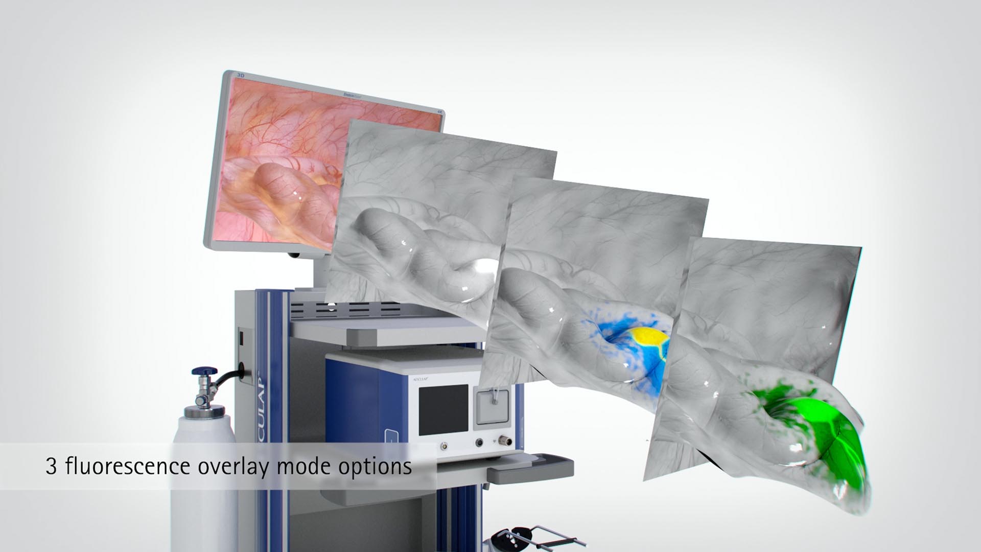 Aesculap - EinsteinVision® 3.0 FI - 3D-Animation - DEJO-Media