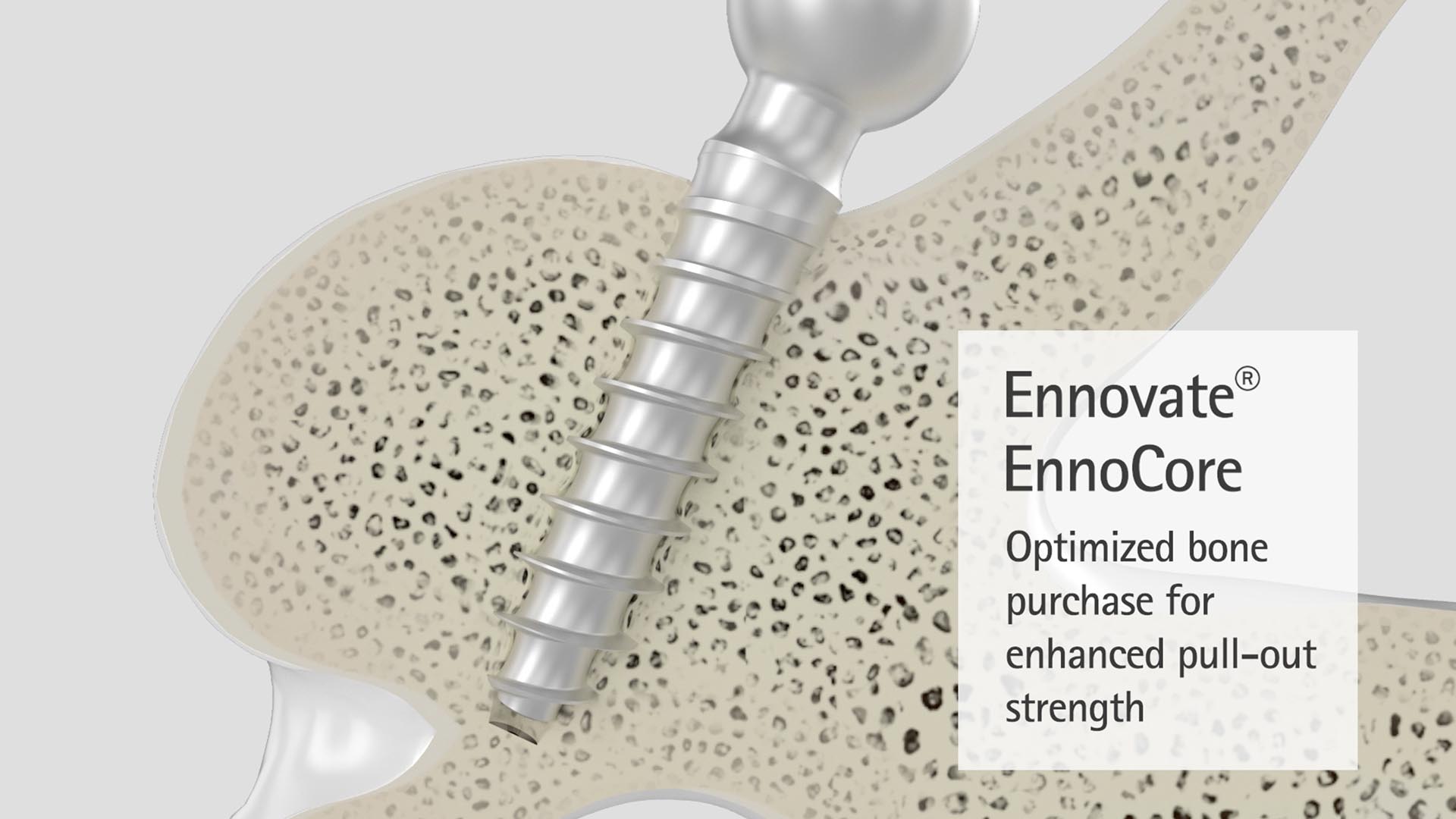 Aesculap - Ennovate® - Spine Days - 3D-Animation - Messevideo - DEJO-Media